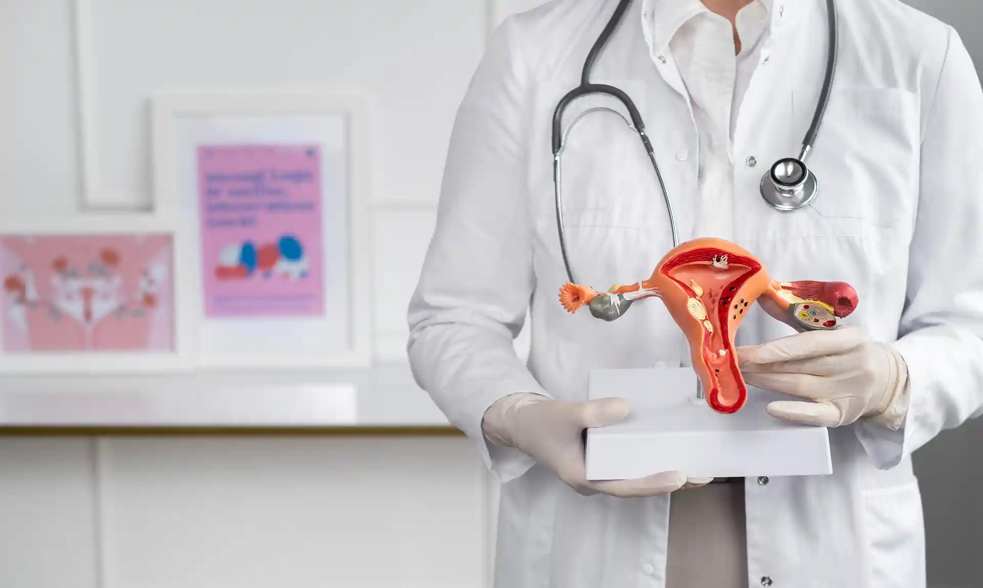 Charitas Group | Prolaps Uteri: Penyebab, Gejala dan Penanganannya